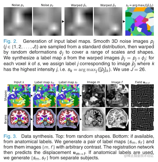 使用pytoch训练SynthMorph持续创作，加速成长！这是我参与「掘金日新计划 · 10 月更文挑战」的第11天， - 掘金