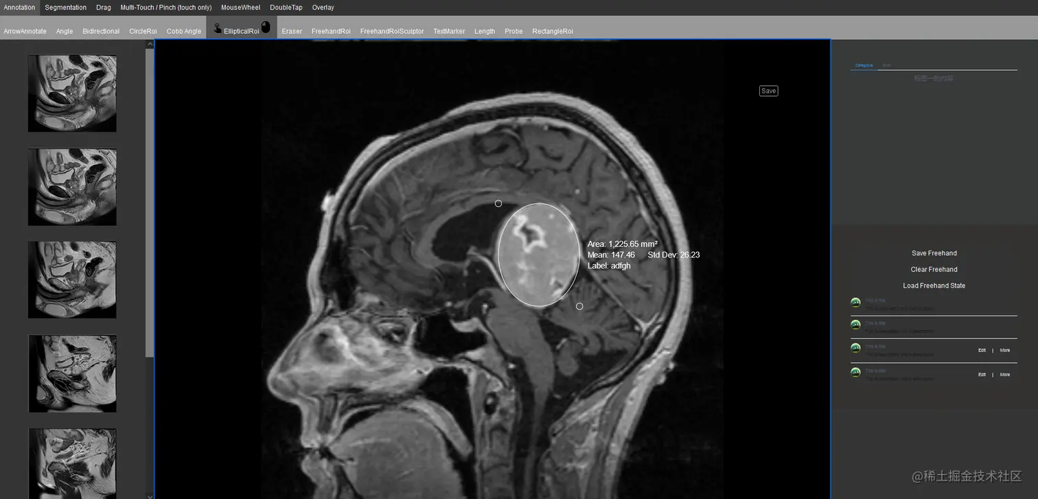 Cornerstone.js之Cornerstone初识Cornerstone是一套JavaScript底层组件，用于支 - 掘金
