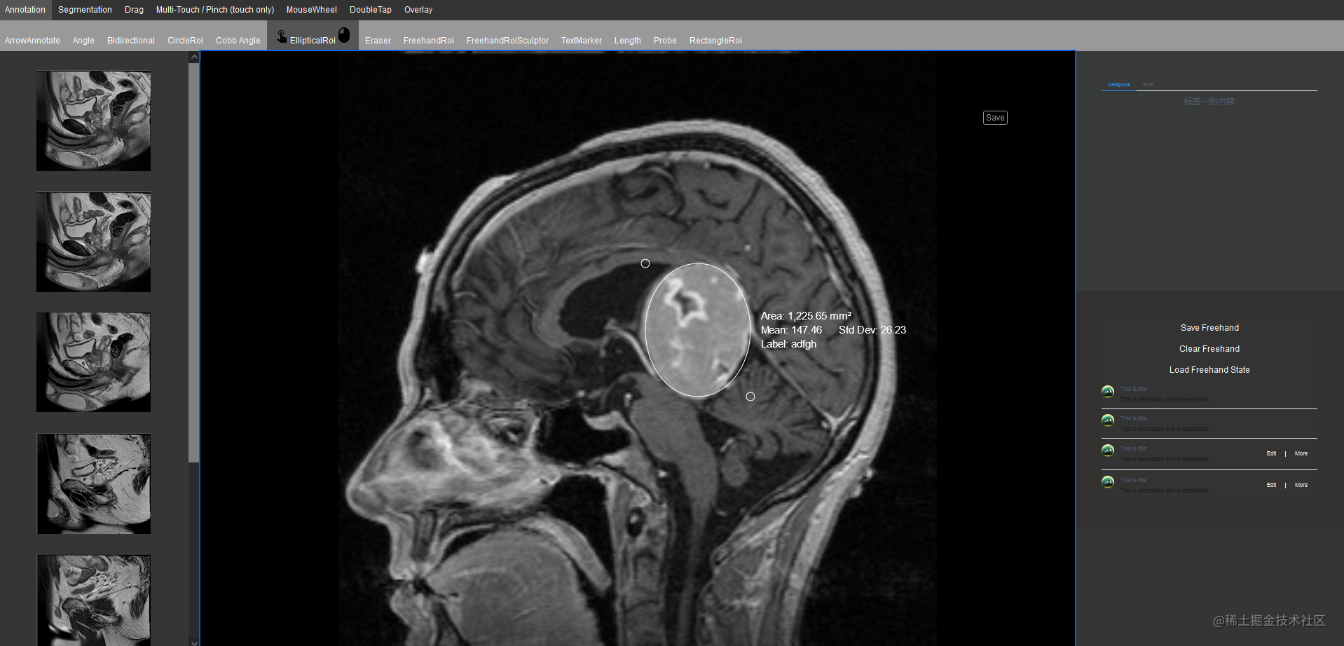 Cornerstone.js之Cornerstone初识 - 掘金